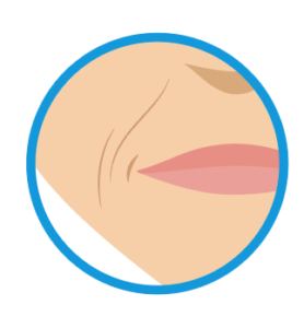 Facial Fillers 101: Basics of Injection Techniques | Dr. Cabin